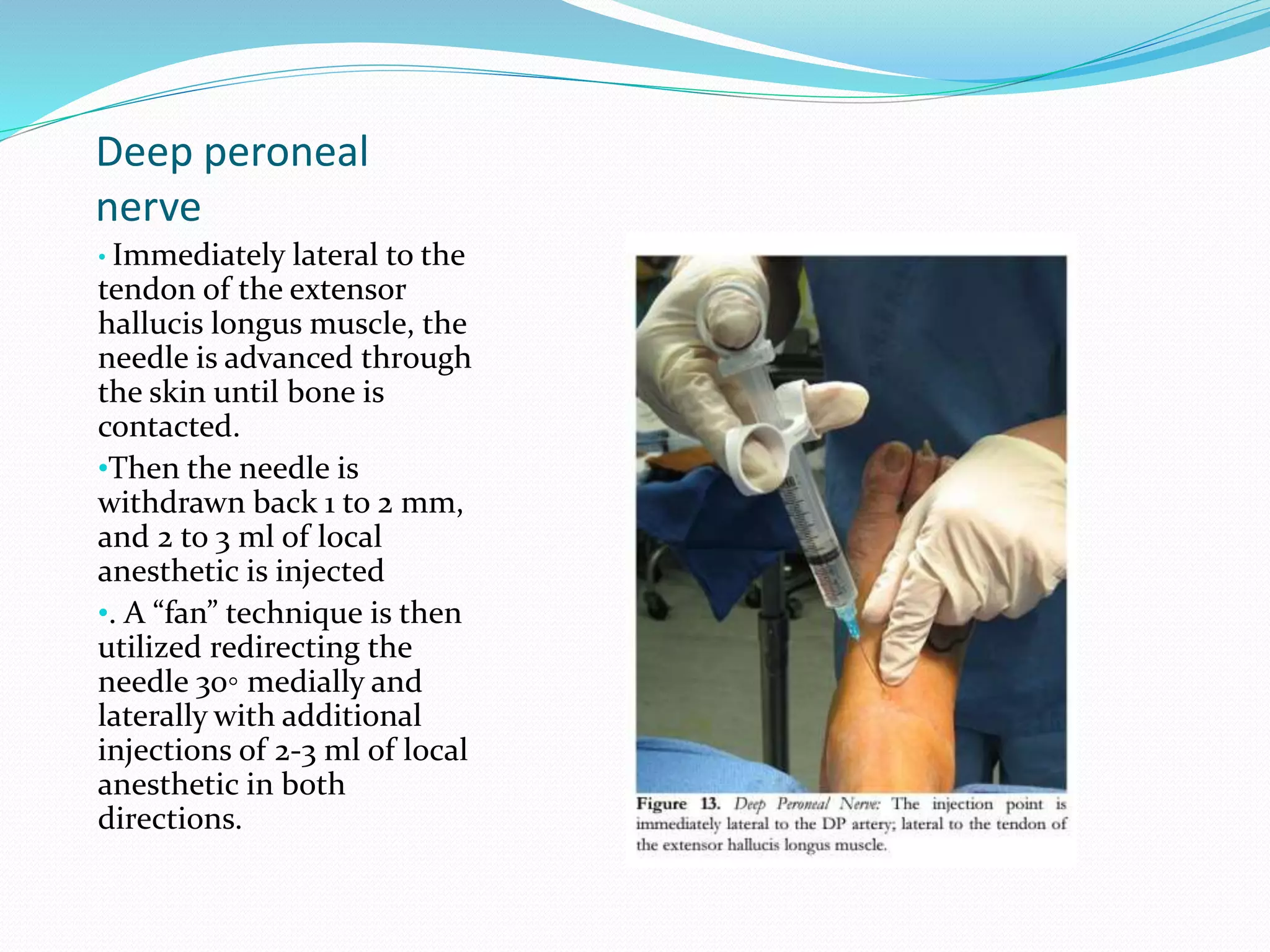 Regional anaesthesia lower limb blocks | PPTX