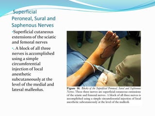 Regional anaesthesia lower limb blocks | PPTX