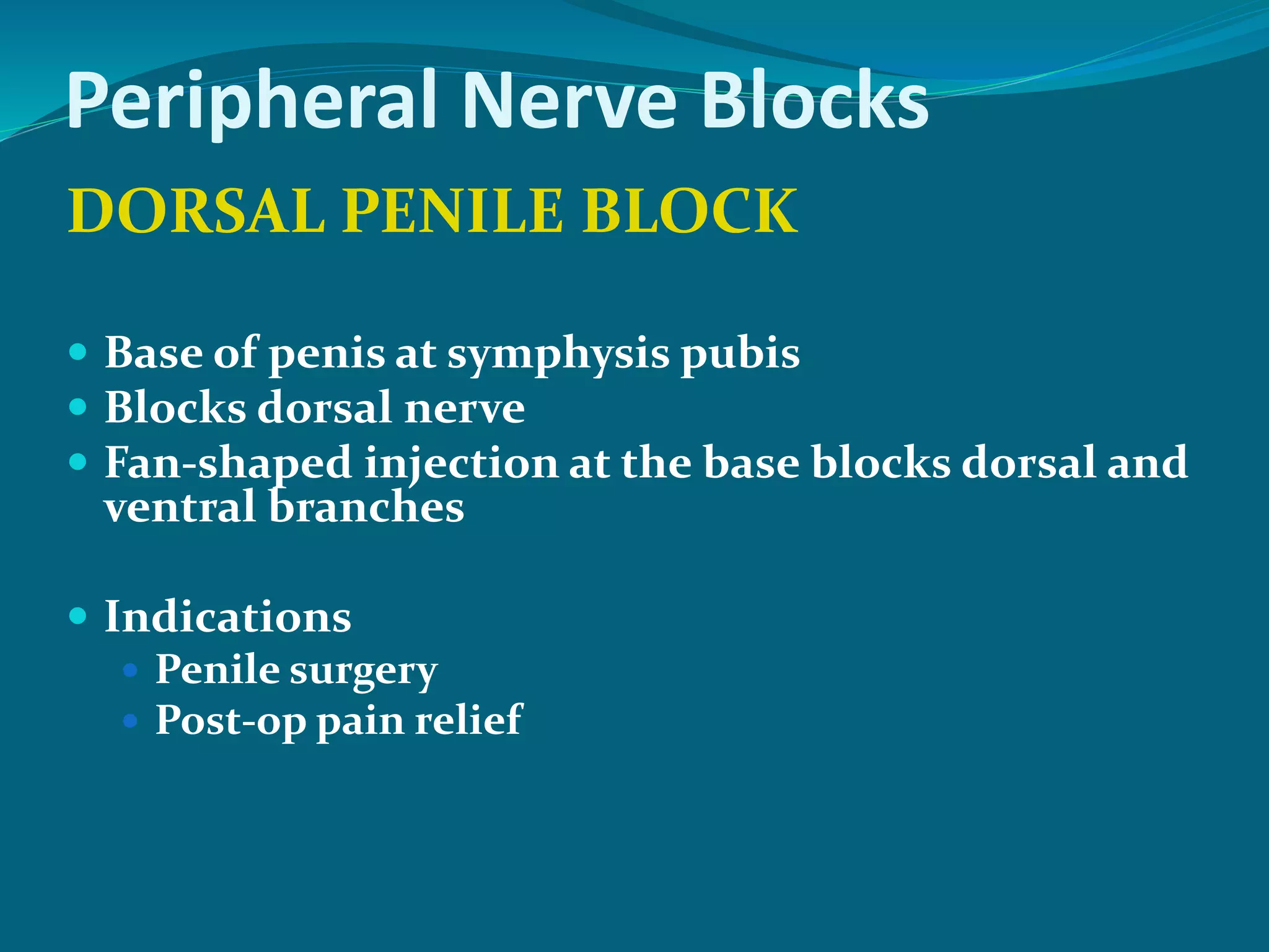 Regional anesthesia | PPTX