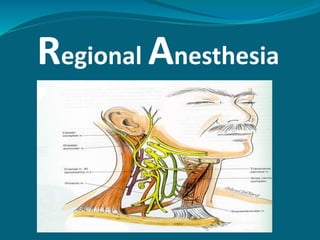 Regional anesthesia | PPTX