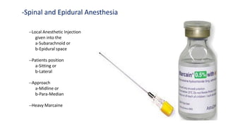 #Regional anesthesia | PPTX