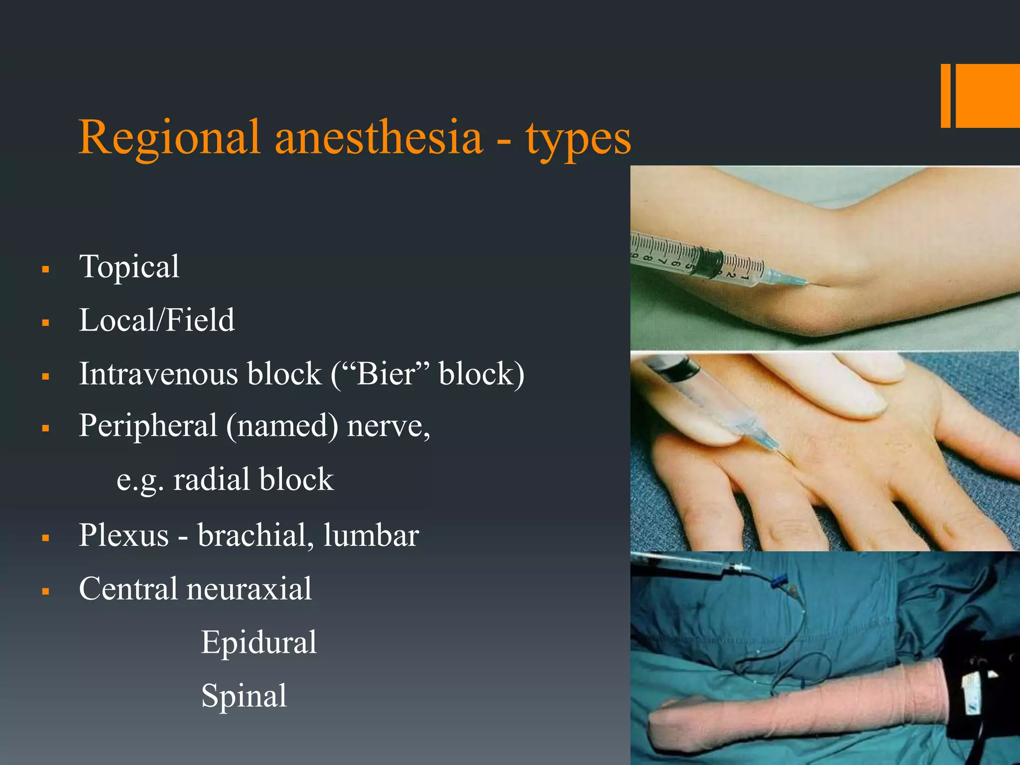 Regional anesthesia by Dr. Ali Mujtaba | PPTX