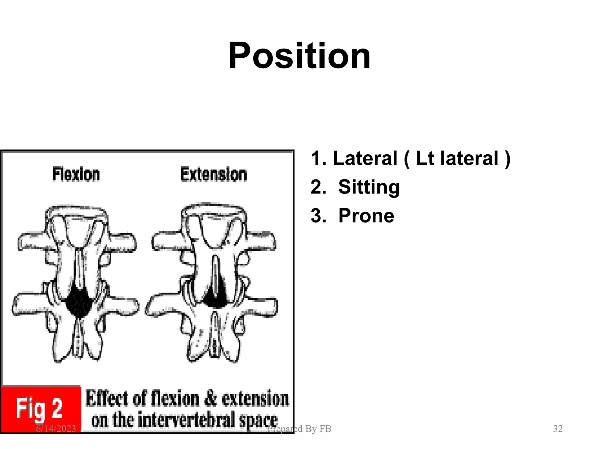 Regional_Anesthesia lec.ppt