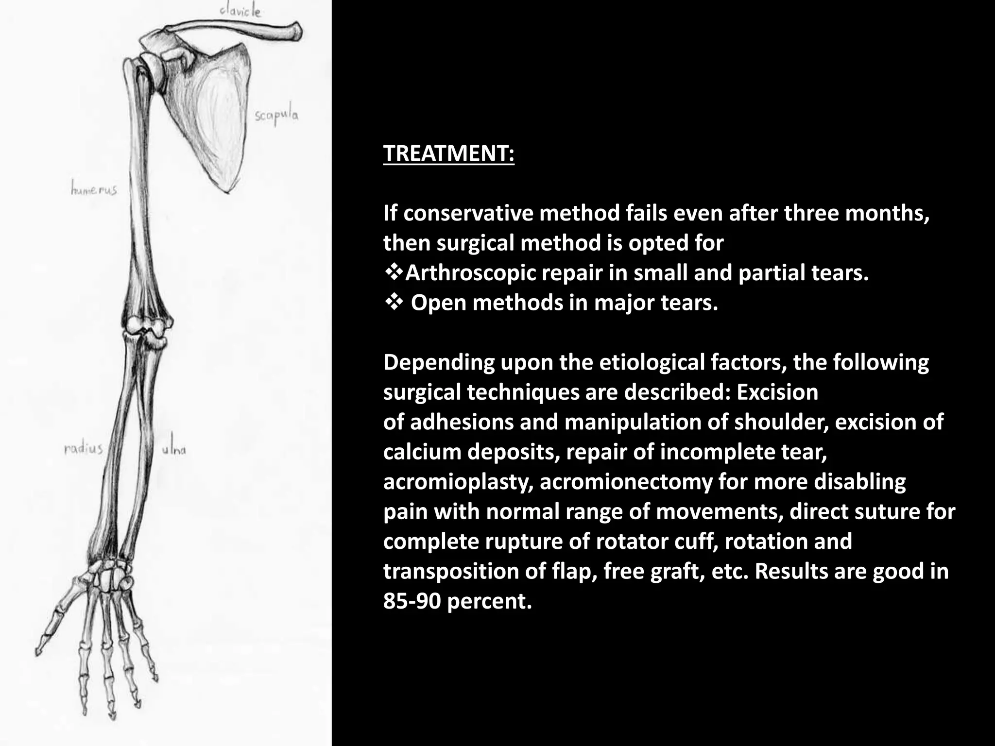 Regional conditions of upper limb | PPTX