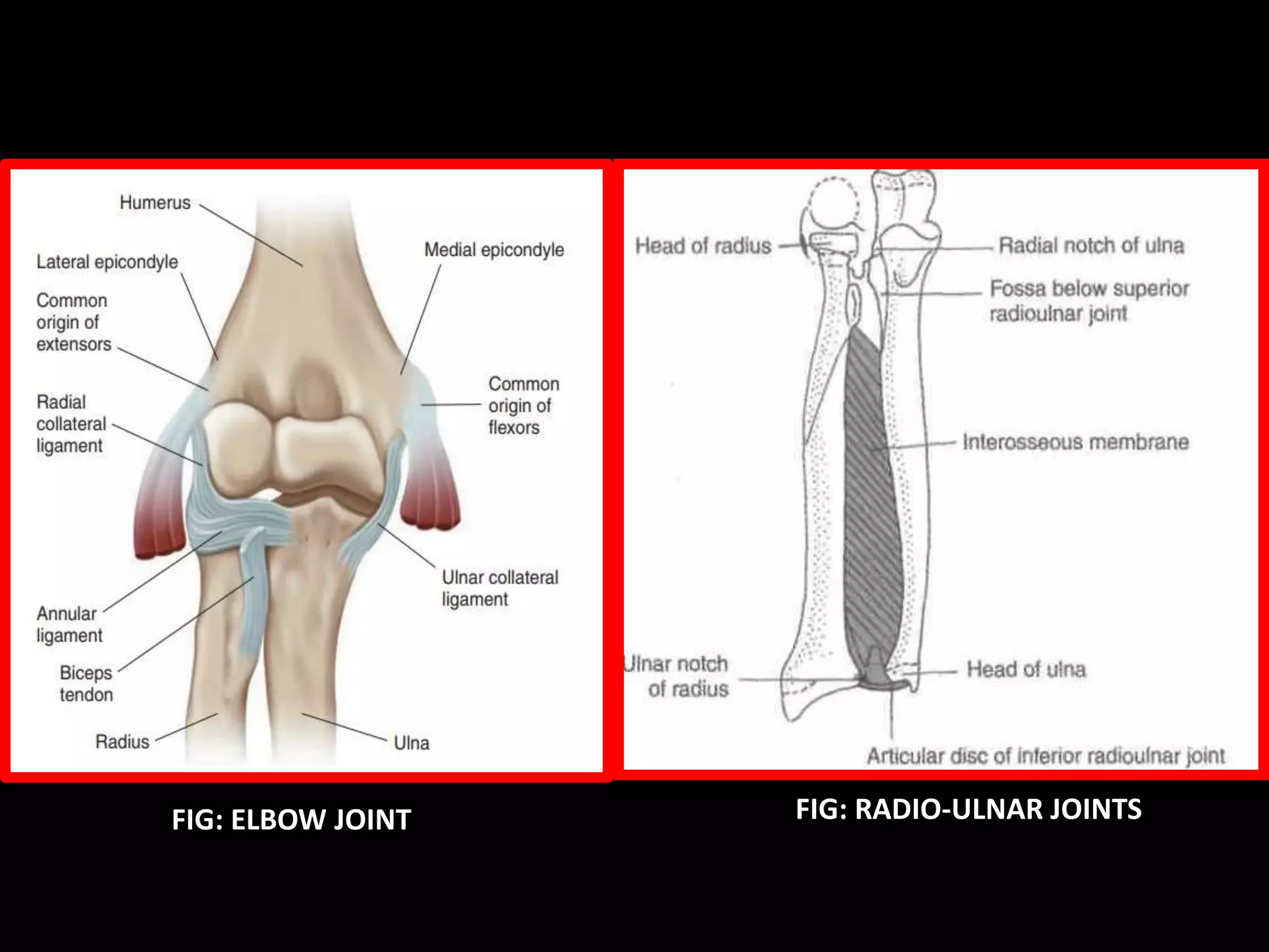 Regional conditions of upper limb | PPTX
