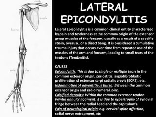 Regional conditions of upper limb | PPTX