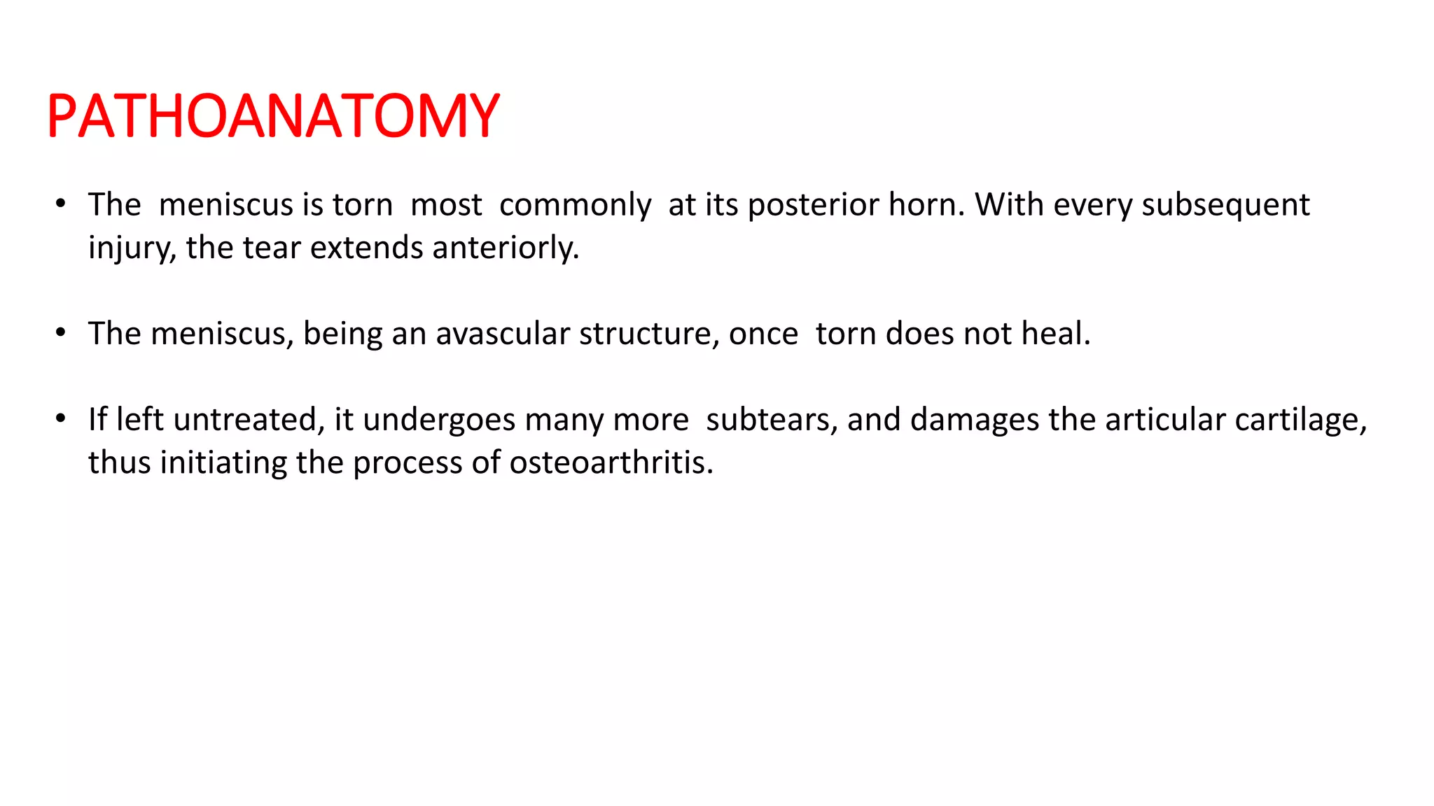 Ligamentous Injuries Around Knee by Dr Arun C Raj, Ortho Resident, KIMS ...