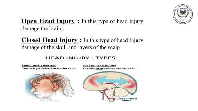 Regional Injury- Head Injury.pptx