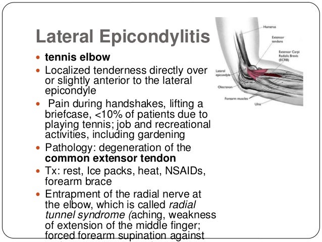 Regional Rheumatic Pain Syndromes
