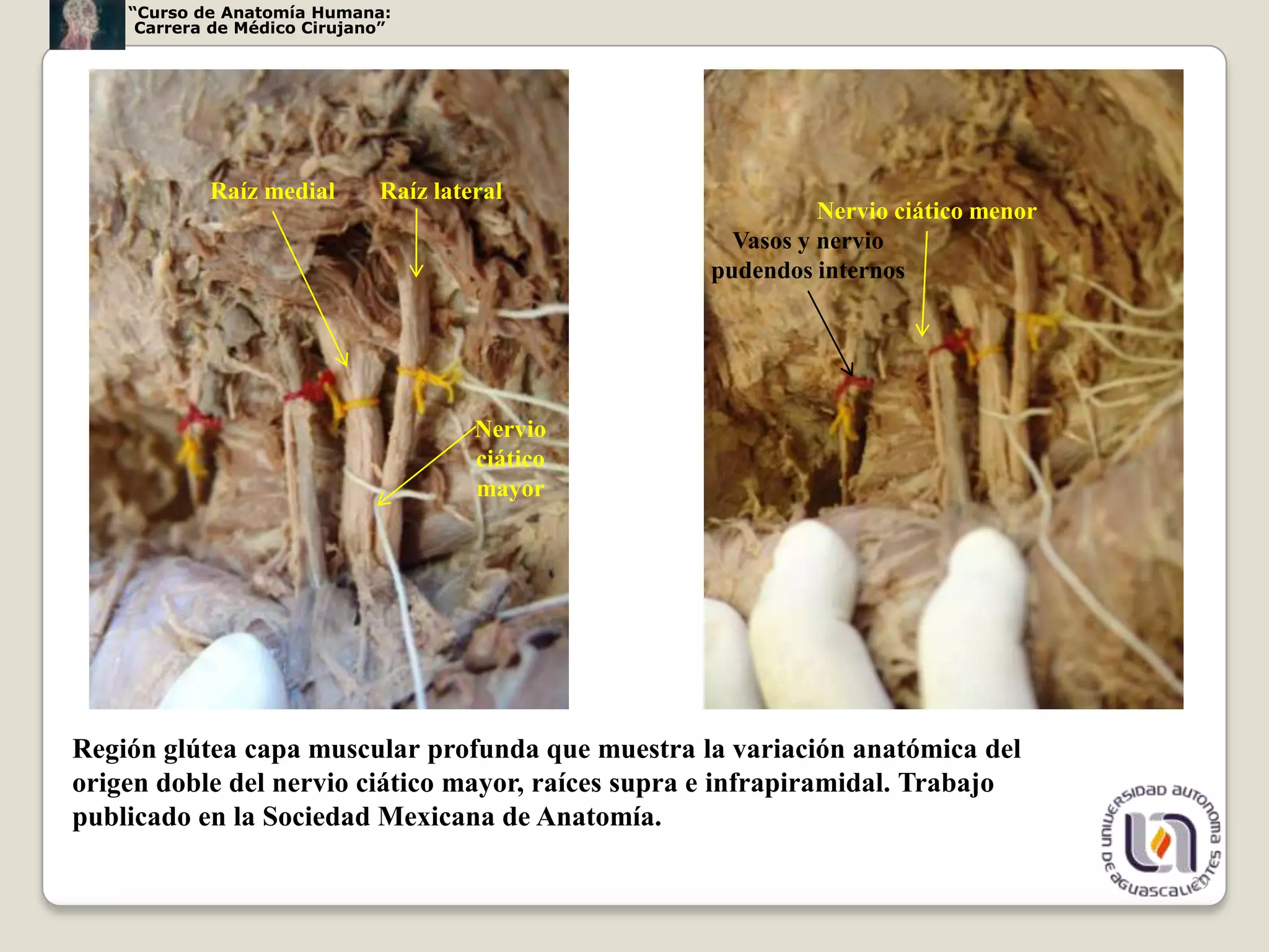 Region glutea | PPTX