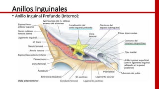 Anatomía quirúrgica de regio Inguinal abierta y laparoscópica | PPTX