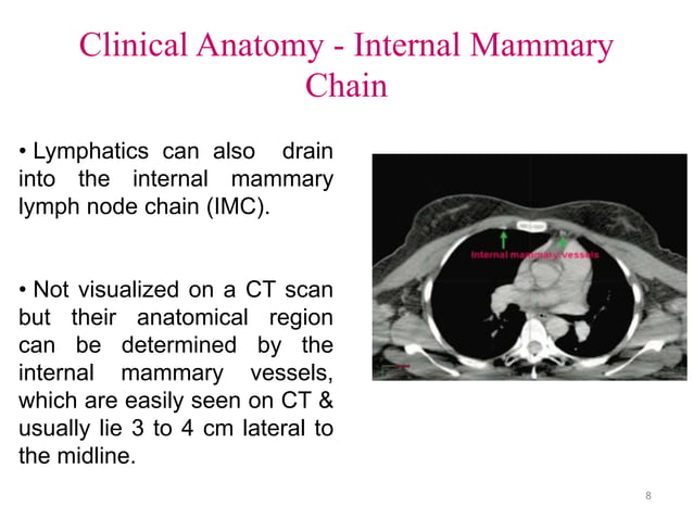 Regional lymph node management in breast cancer | PPT