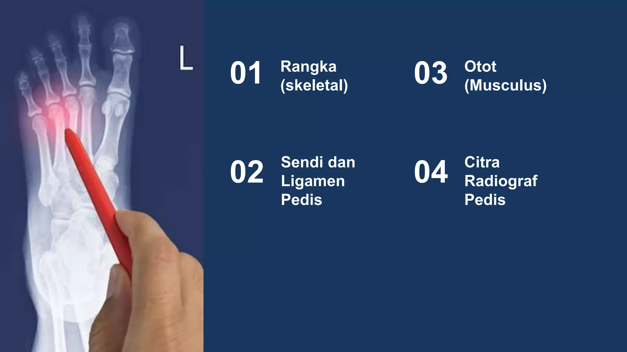 REGIO PEDIS_Inayah Mumpuni B_Harimulti A Wibowo.pptx