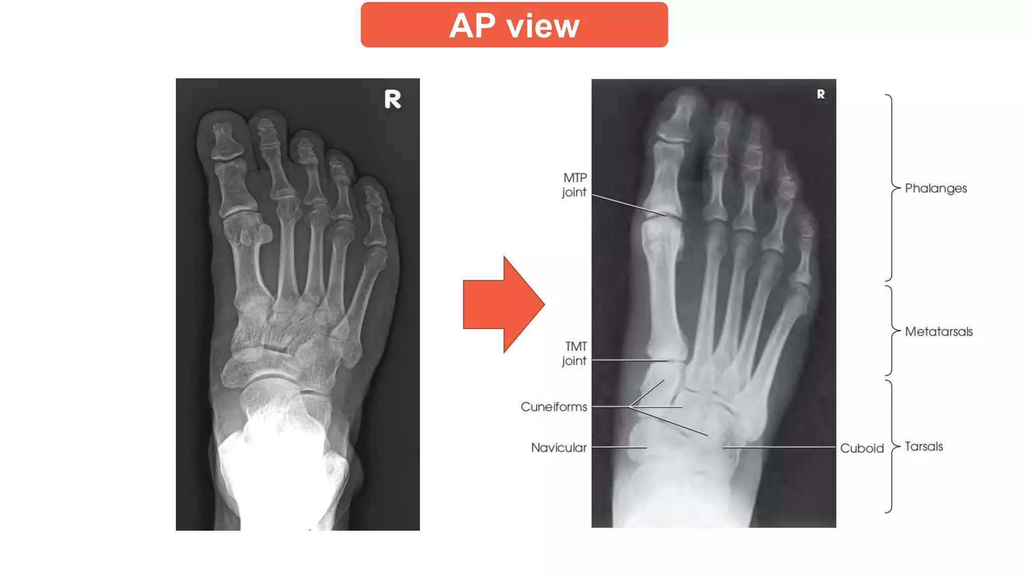 REGIO PEDIS_Inayah Mumpuni B_Harimulti A Wibowo.pptx