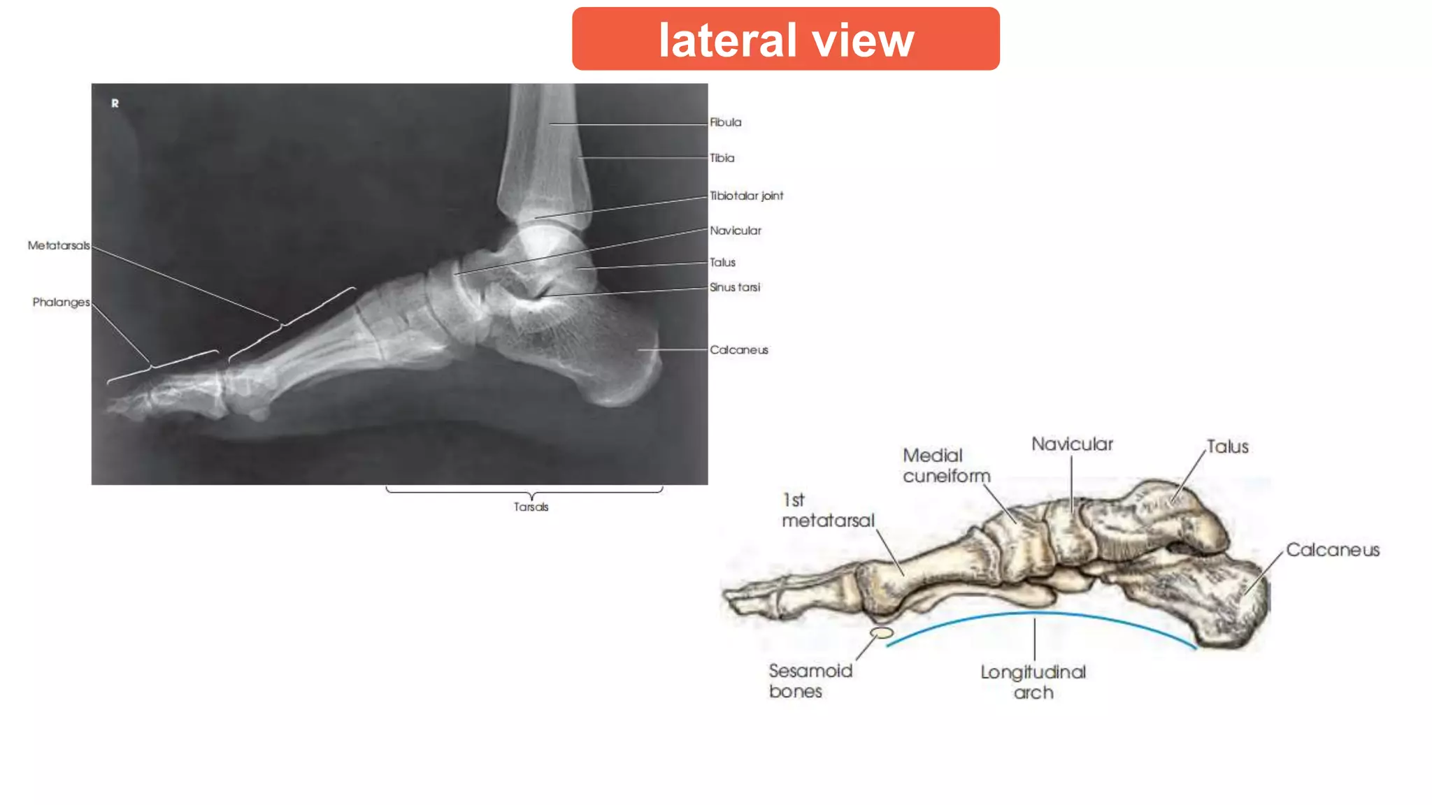 REGIO PEDIS_Inayah Mumpuni B_Harimulti A Wibowo.pptx