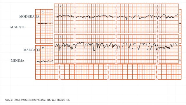 registro cardiotocografico