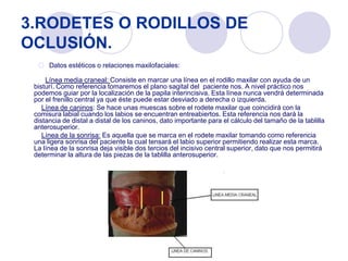 Registros de mordida | PPT