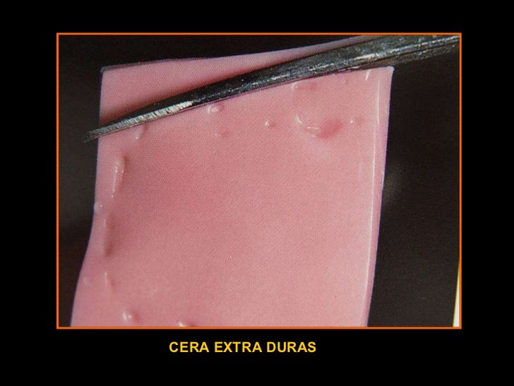 Registros Oclusales