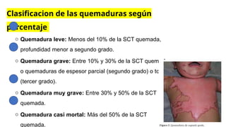 REGLA DEL 9 % usado en quemaduras adulto y niños .pptx