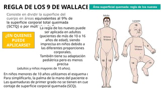 REGLA DEL 9 % usado en quemaduras adulto y niños .pptx