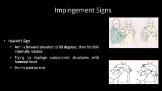 regonal pain (1) (1).pptx.............. | PPT