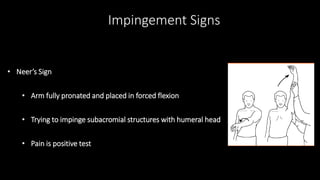 regonal pain (1) (1).pptx.............. | PPT