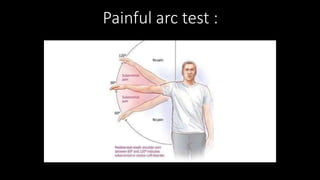 regonal pain (1) (1).pptx.............. | PPT