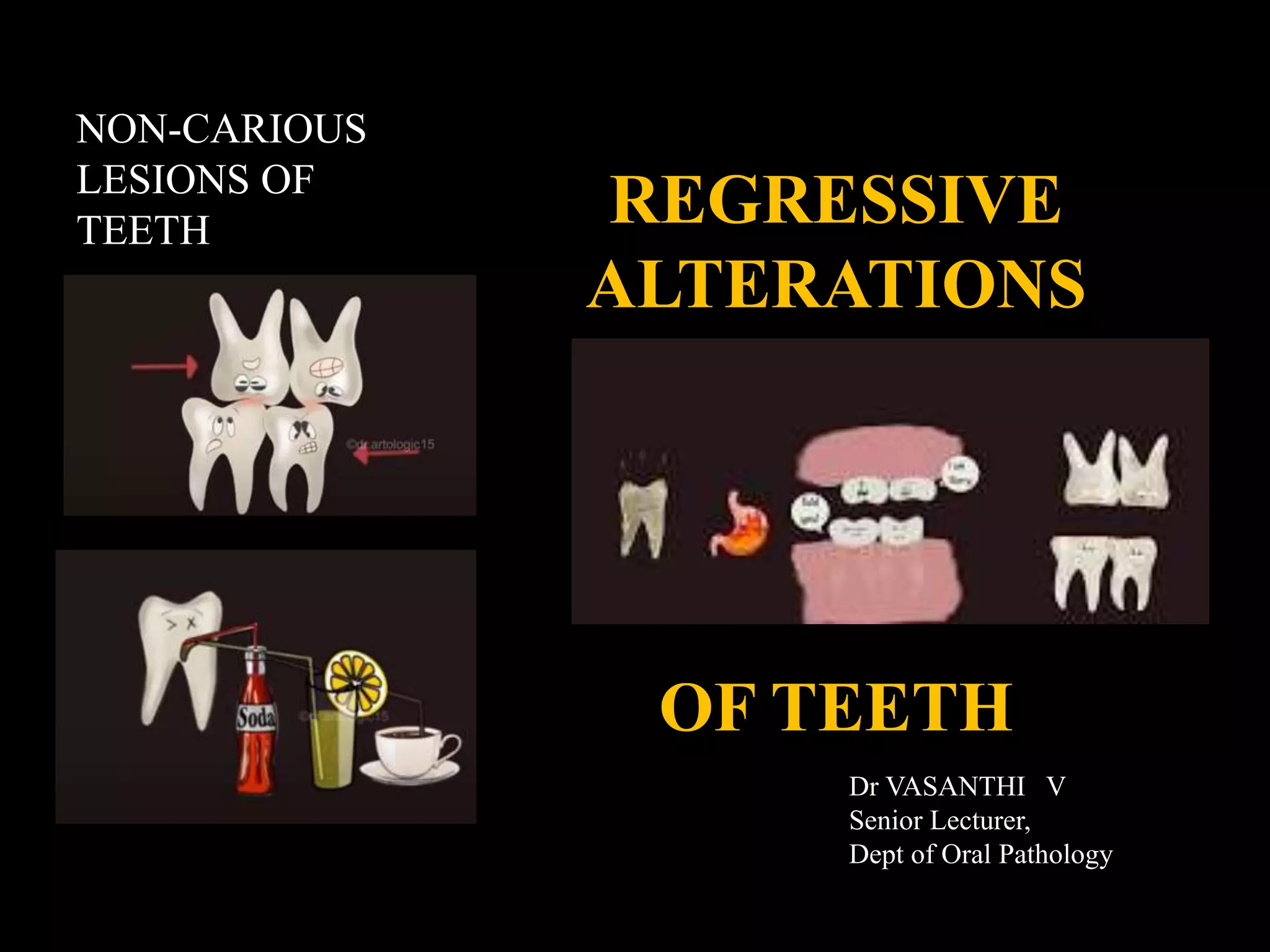 Regressive alterations of teeth | PPTX
