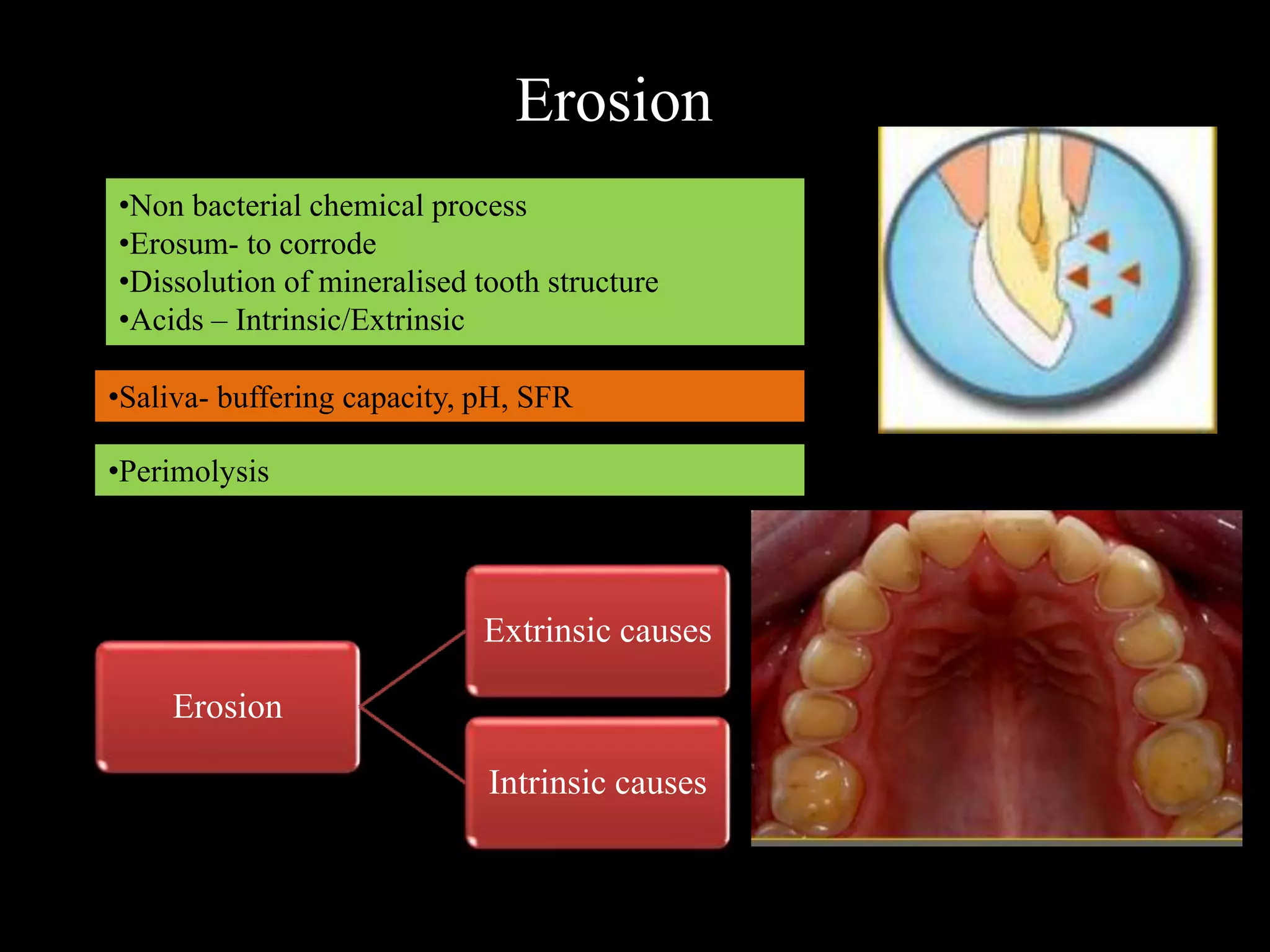 Regressive alterations of teeth | PPTX
