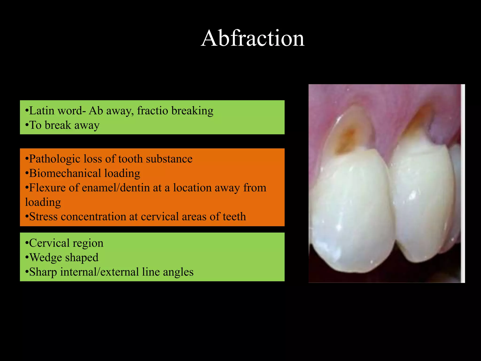 Regressive alterations of teeth | PPTX