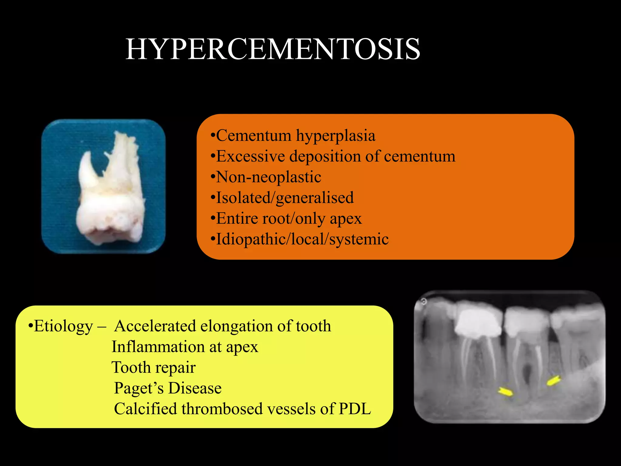 Regressive alterations of teeth | PPTX