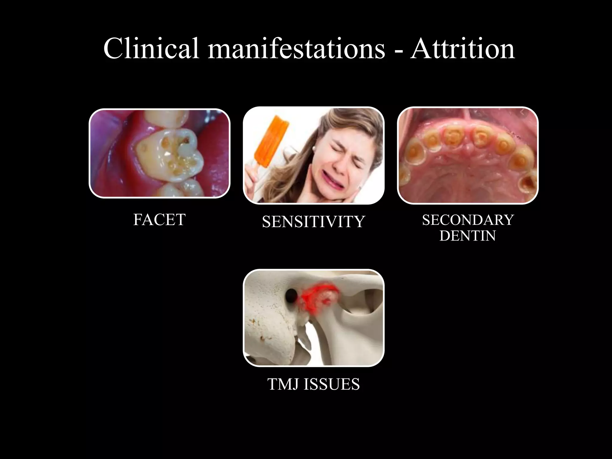 Regressive alterations of teeth | PPTX
