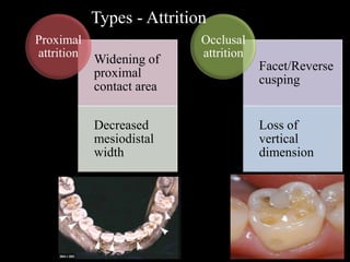 Regressive alterations of teeth | PPTX