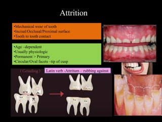 Regressive alterations of teeth | PPT
