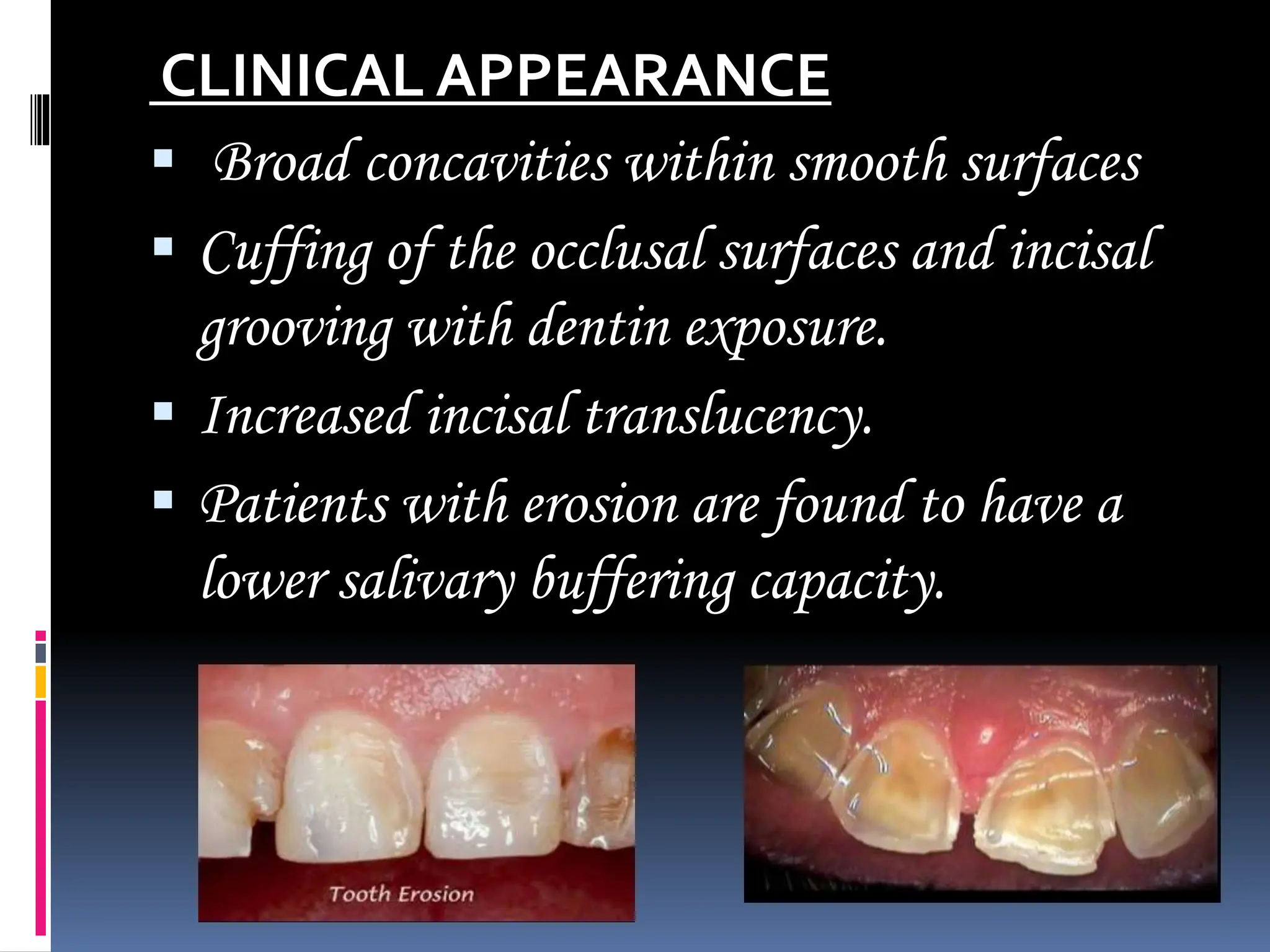REGRESSIVE ALTERATIONS OF THE TEETH.pptx