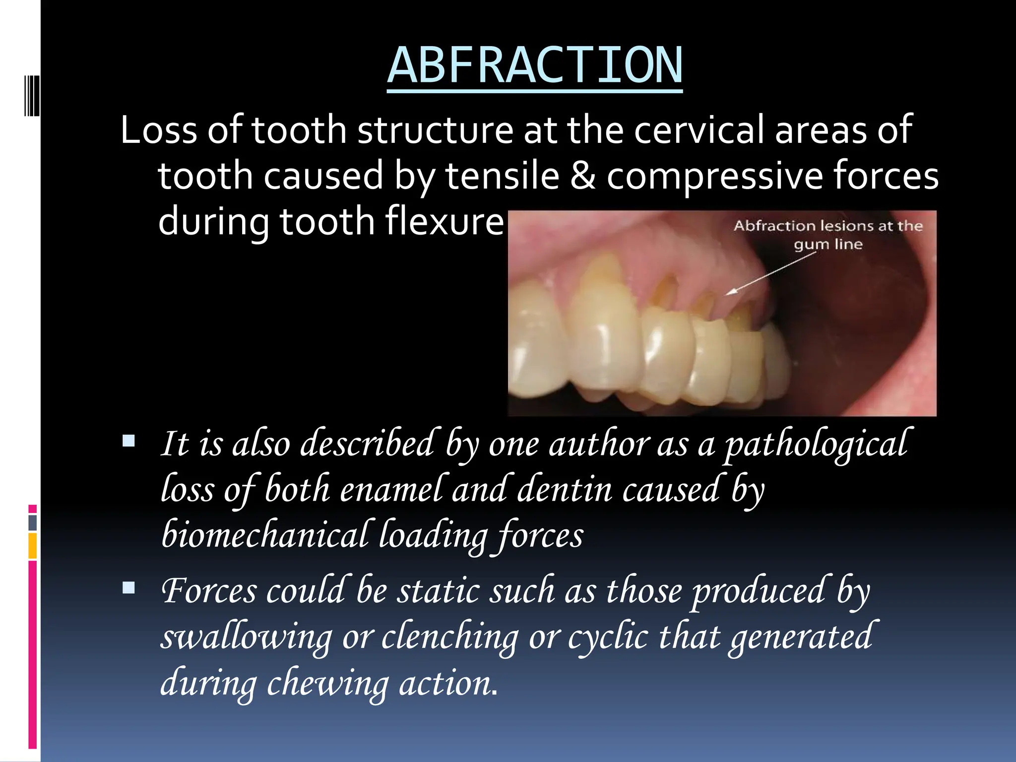 REGRESSIVE ALTERATIONS OF THE TEETH.pptx