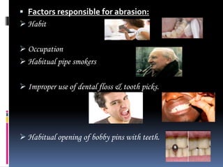 REGRESSIVE ALTERATIONS OF THE TEETH.pptx