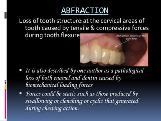 REGRESSIVE ALTERATIONS OF THE TEETH.pptx
