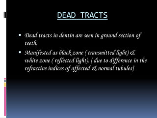REGRESSIVE ALTERATIONS OF THE TEETH.pptx
