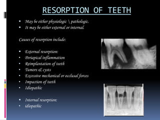 REGRESSIVE ALTERATIONS OF THE TEETH.pptx