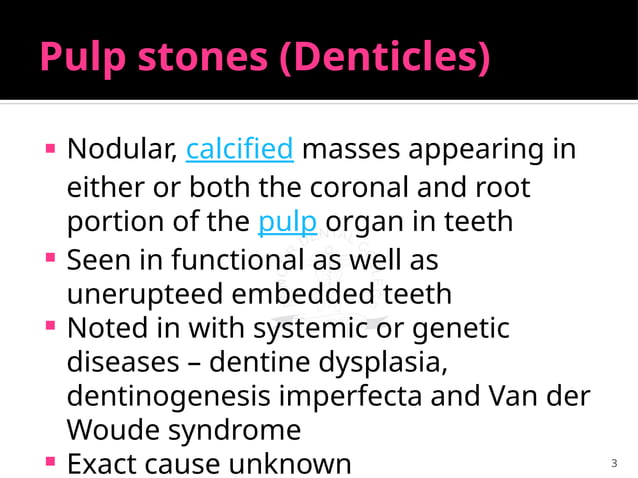 Regressive alterations pulp stones ppt..pptx
