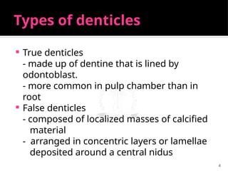 Regressive alterations pulp stones ppt..pptx