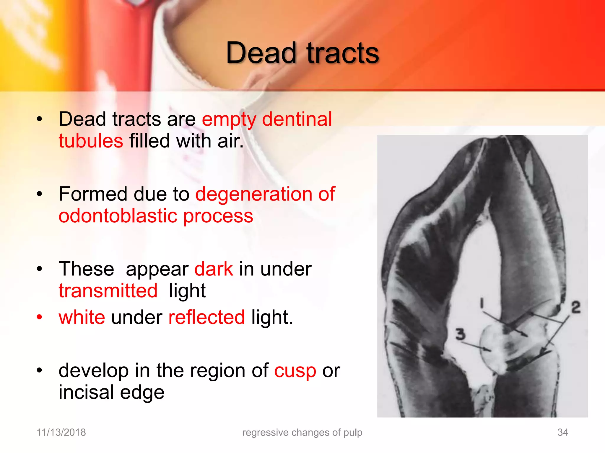 Regressive changes of pulp | PPTX