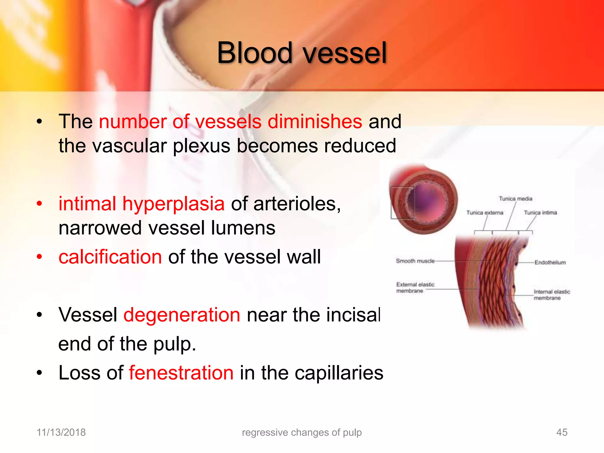 Regressive changes of pulp | PPTX