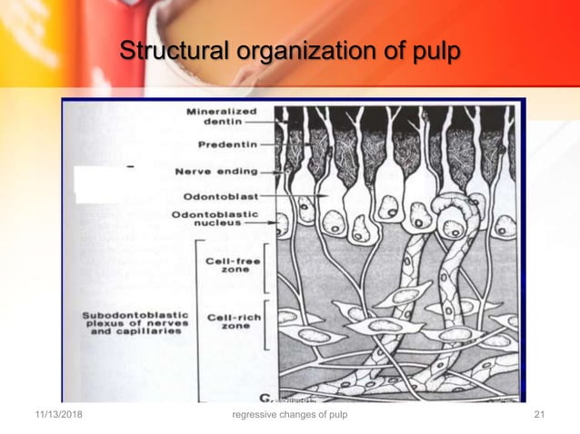 Regressive changes of pulp | PPTX