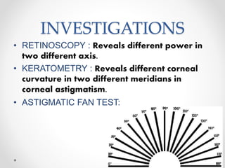 Regular astigmatism by Dr.vinay gadiputi | PPTX