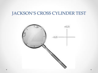 Regular astigmatism by Dr.vinay gadiputi | PPTX