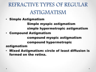 Regular astigmatism by Dr.vinay gadiputi | PPTX