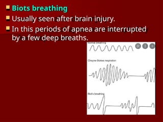 pulmonary physiology-Regulation Chemical control.pptx