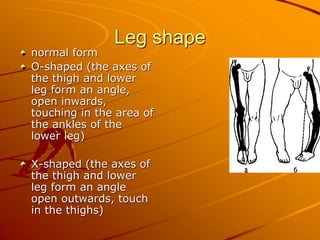 rehabiitation ppt.ppt